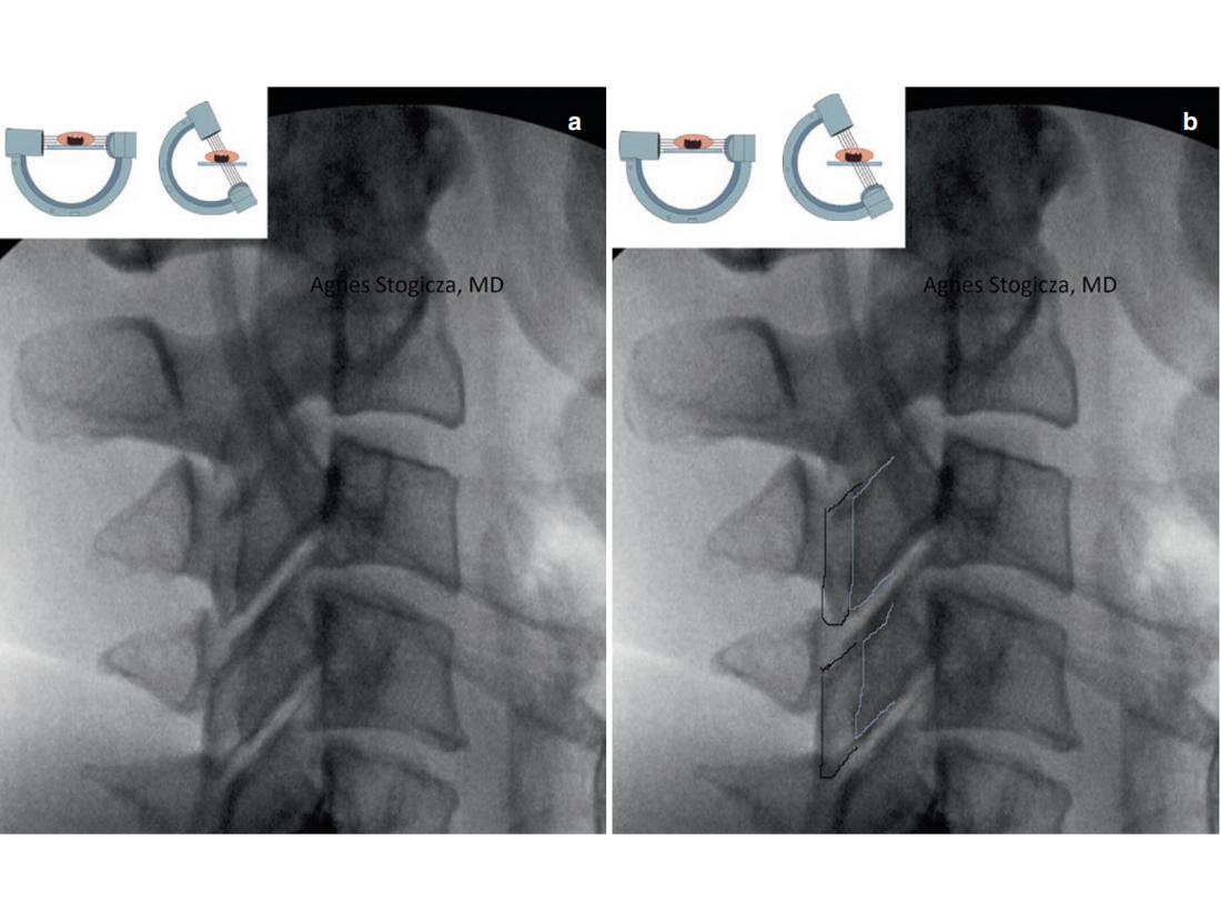 Interventional Pain | PocketEDU