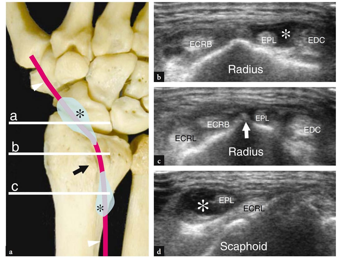 Ultrasound of the Musculoskeletal System | PocketEDU