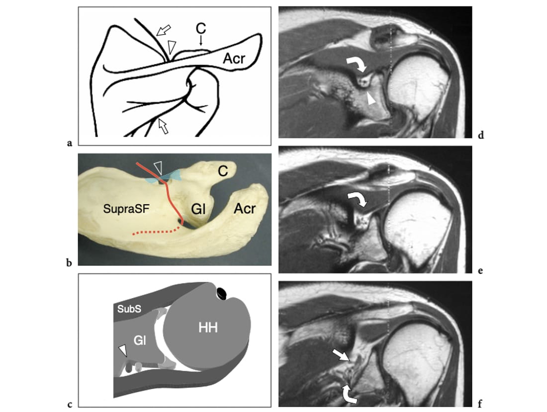 Ultrasound of the Musculoskeletal System | PocketEDU